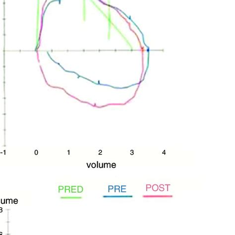 Pre And Post Bronchodilator Spirometry Source Authors Download
