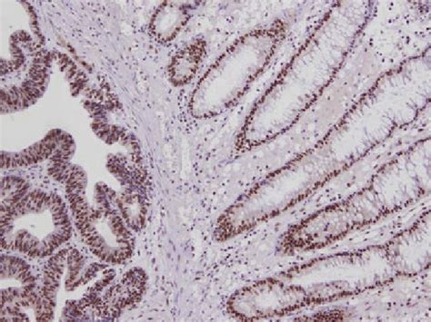 And Figure 2 Show The Ihc Staining Reactivity Patterns With The