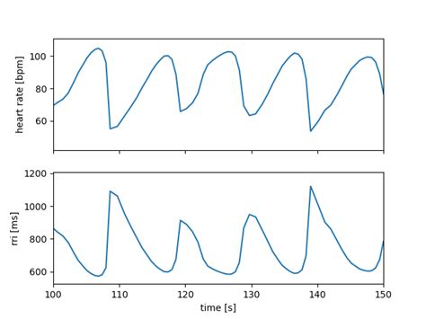 Ecg Tutorial — Physio Documentation