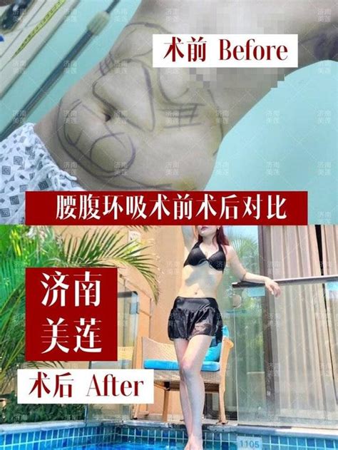 減肥的方法你聽過很多但是真的有效且安全的就這一個 每日頭條