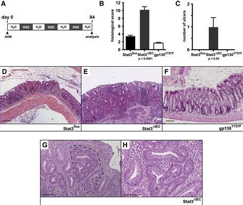 Gp130 Mediated Stat3 Activation In Enterocytes Regulates Cell Survival