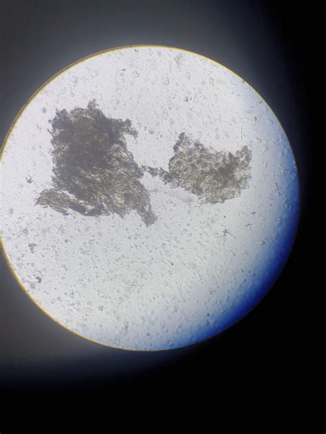 Any Idea What This Is In My Starch Sample R Microscopy
