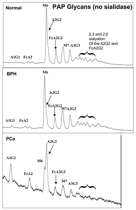 Normal Phase Hplc Separation Of 2 Ab Derivatized N Linked Glycans From Download Scientific