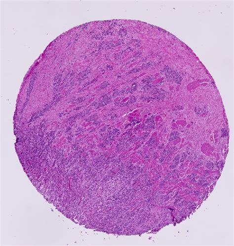 Handeihc Warpy Overlaying Image Analysis Imagesc Forum