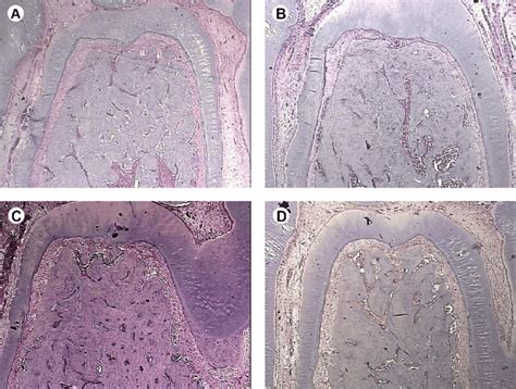 Photomicrograph Showing Bone Density After Subcutaneous Injections Of