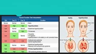 Thyroid Function Tests PPTX