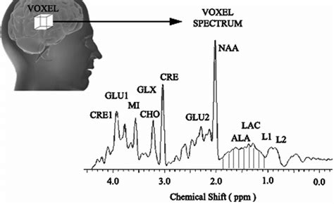 The Metabolite Spectrum Generated From A Brain Voxel Y Axis Peak Download Scientific Diagram