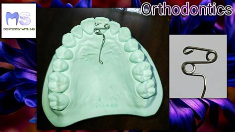 Z Spring Fabrication Double Cantilever Spring Z Spring Orthodontics