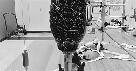 Poll I Work As A Prosthetistorthotist And Wanted To Know How Many People Would Be Interested