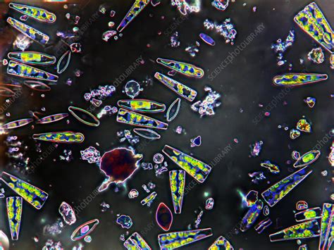 Mixed Diatoms Under Microscope