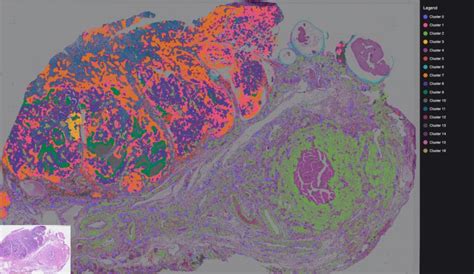 Excited To Share Our New Method For Detecting Spatial Cell Type Domains