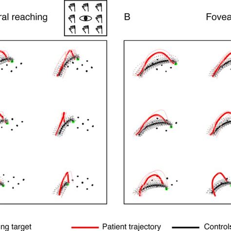 Reaching Trajectories Of Patient St And Control Participants A