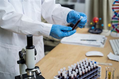 실험실 배경에서 분석의 혈액 샘플 튜브를 복용 하는 의사 손 Stem 주제에 대한 스톡 사진 및 기타 이미지 Stem 주제