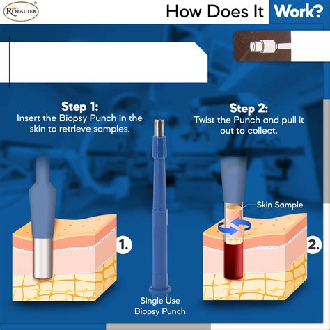 Sterile Disposable Biopsy Punches Precision Medical Instruments