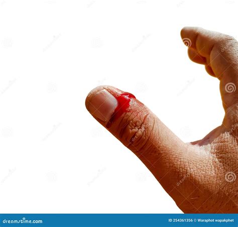 Herida De Mano Y Sangre En Fondo Blanco Foto De Archivo Imagen De