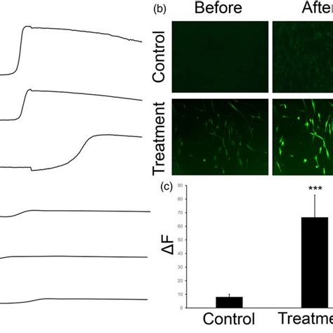 Neural Differentiation Of Human Neural Crest Stem Cells NCSCs And
