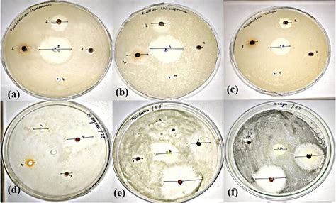 Zones Of Inhibition In Microbial Strains A Pseudomonas Fluorescens Download Scientific