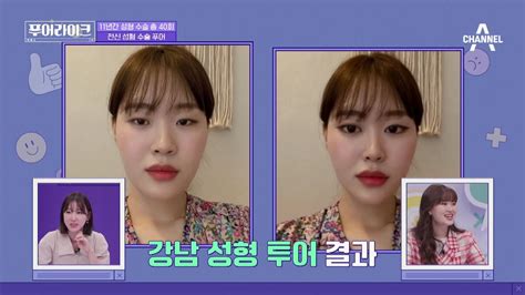 선공개 11년간 40회 전신 성형 받은 수술 푸어 등장 엄지윤의 견적은 큰 거 한 장 푸어라이크 6 회 Youtube