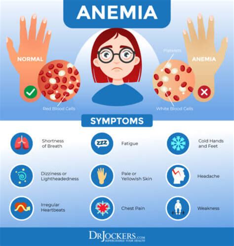 Anemia Causes Symptoms And Support Strategies DrJockers