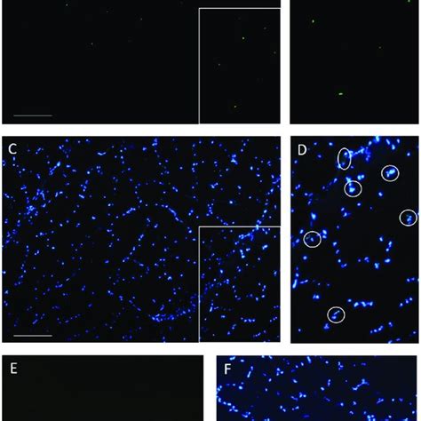 Immunhistochemical Staining Of A Cross Section Of The Skeletal Muscle