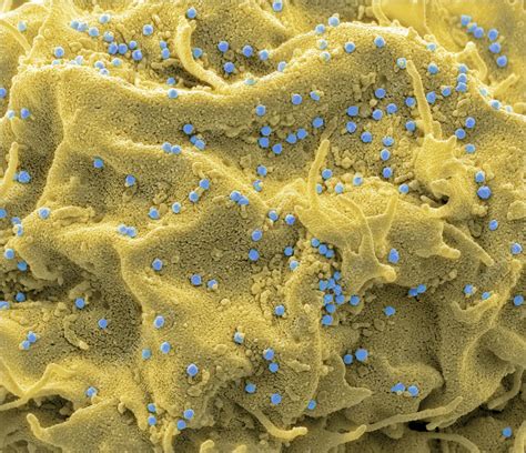 Varicella Zoster Virus Sem Stock Image C061 2993 Science Photo Library