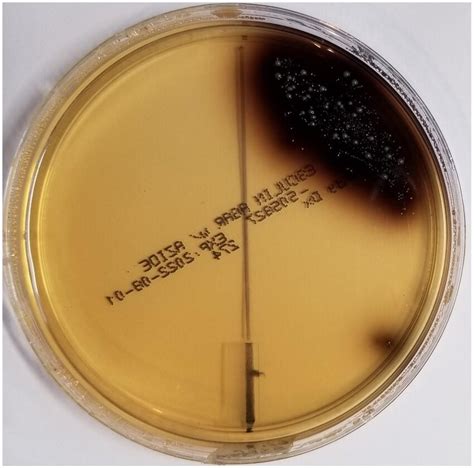 Bea Agar Plate Assay Confirming The Presence Of Microorganisms