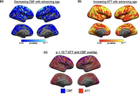 Spatial Maps Of Surface Based Group Analysis For Significant Impact Of