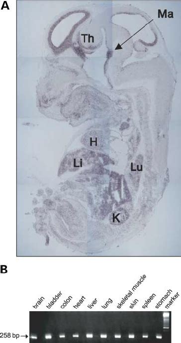 A Expression Of Aspm In E14 Whole Mouse Embryo Detected By