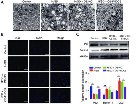 The Anti Autophagy Effect Of Fndc5 In Bmscs Subjected To Hsd Injury
