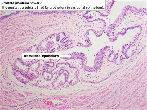 Prostate Normal Histology Nus Pathweb Nus Pathweb