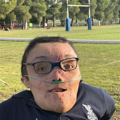 Muri Capocha El Joven De Bah A Blanca Que Inspir A Miles De Personas Con Su Historia