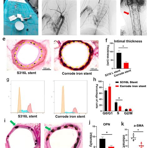 Corroded Granules Inhibited Vsmc Proliferation In Vitro A B Vsmc