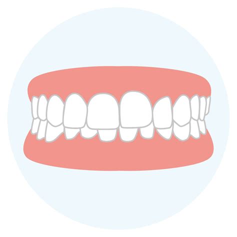 Spark Aligners In Chapel Hill Nc Clifton And Mauney