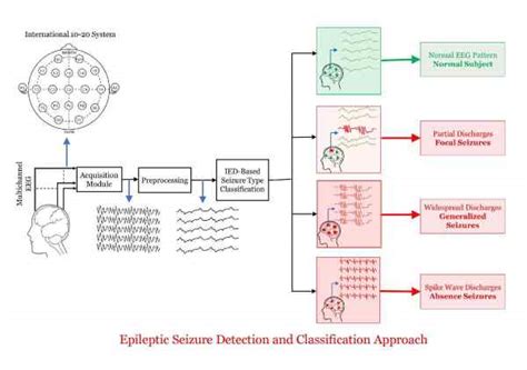 Iisc And Aiims Develop Algorithm To Identify Occurrence And Type Of