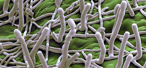 Downy Mildew Microscope