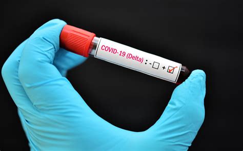 Variant Delta Ce Virus Est Désormais Lun Des Plus Transmissibles