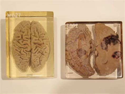 Einstein Brain