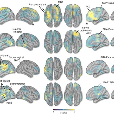 Pdf Imaging Cortical Engagement During Motor Imagery Mental Arithmetic And Silent Word