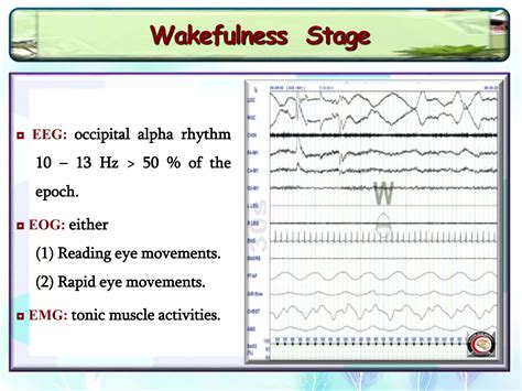 Polysomnogram Interpretetion Pptx