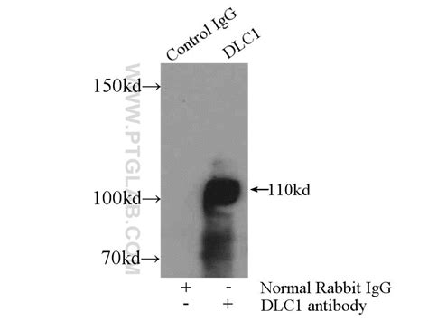 DLC1 antibody (15460-1-AP) | Proteintech