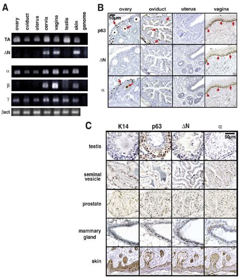 Krt14 Immunohistochemistry Gene Expression Assay Gxd