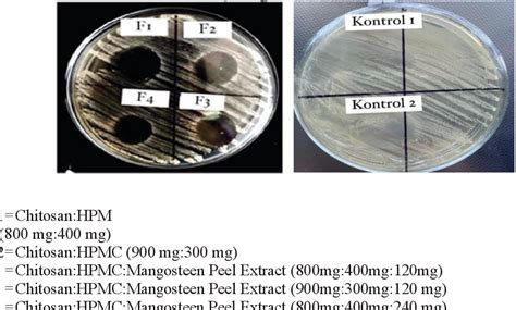 Figure 2 From Formulation Of Acne Patch From Garcinia Mangostana L Peel