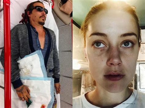 德普「斷指」事件證人1 艾梅伯被指患有雙重人格 每日頭條