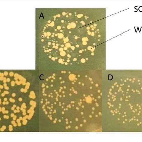 Pdf Spontaneously Occurring Small Colony Variants Of Staphylococcus Aureus Show Enhanced