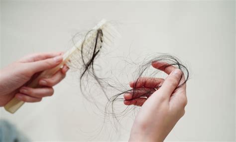 Female Hair Loss Understanding The Causes Treatment Options And