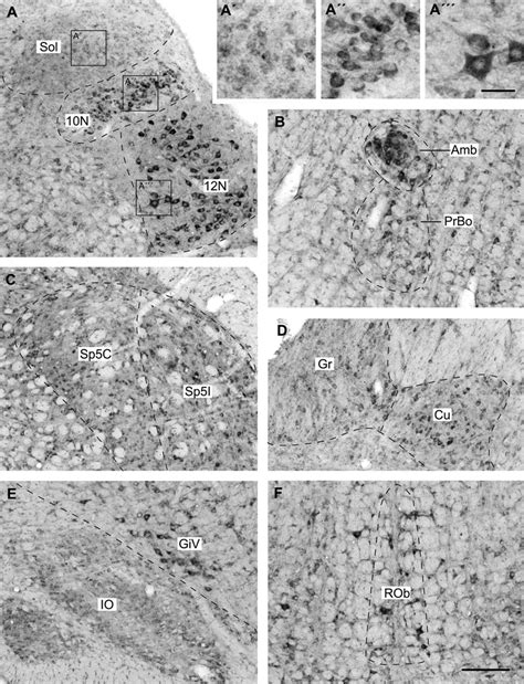 High Power Photomicrographs Showing Ca V 13 Ir In Some Selected Nuclei