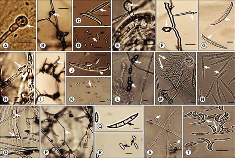 Fusarium Spp