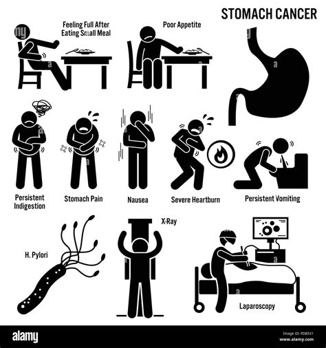Stomach Cancer Symptoms Causes Risk Factors Diagnosis Stick Figure