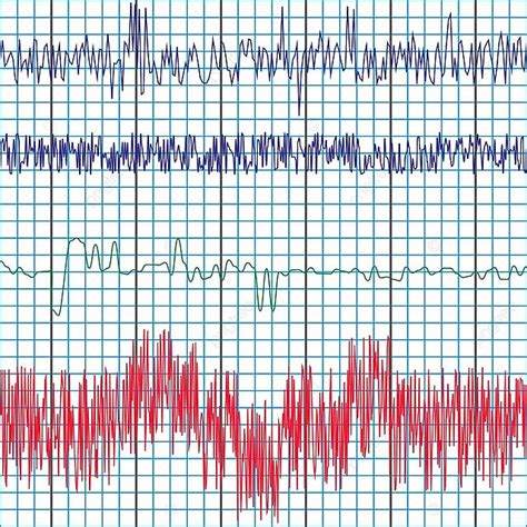 Screen Recording Polygraph Polygraph Instrument Sheet Vector Polygraph