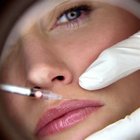 Botox Before And After Lips Gone Wrong
